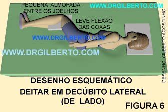 R P G Reeducação Postural Global Tratamento Natural