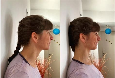 Computer And Smart Phone Posture Problems And Fixes Part 1 Forward Head