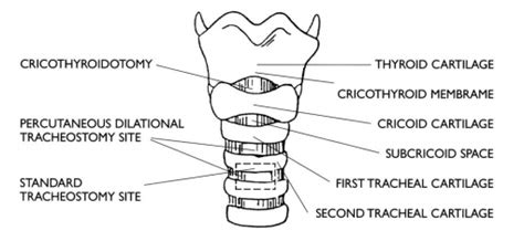 Neck Anatomy For Tracheostomy Site Critical Care Practitioner