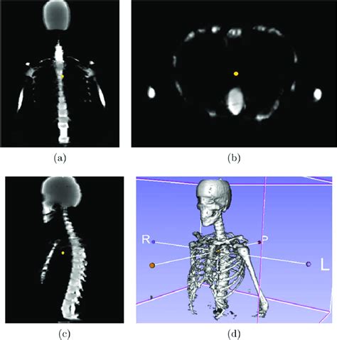 Reconstructed Optical Ct Sections Of Phantom Ii In Coronal A