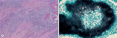 Non Hepatotropic Viral Bacterial And Parasitic Infections Of The Liver