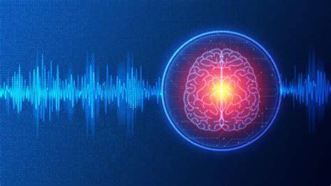 Ask Dr Armstrong How Do Neuromodulation Devices Prevent Migraine