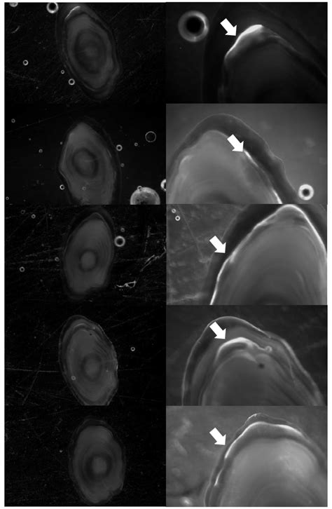 The Otoliths Of Marbled Flounder Under Uv Light Wig Filter