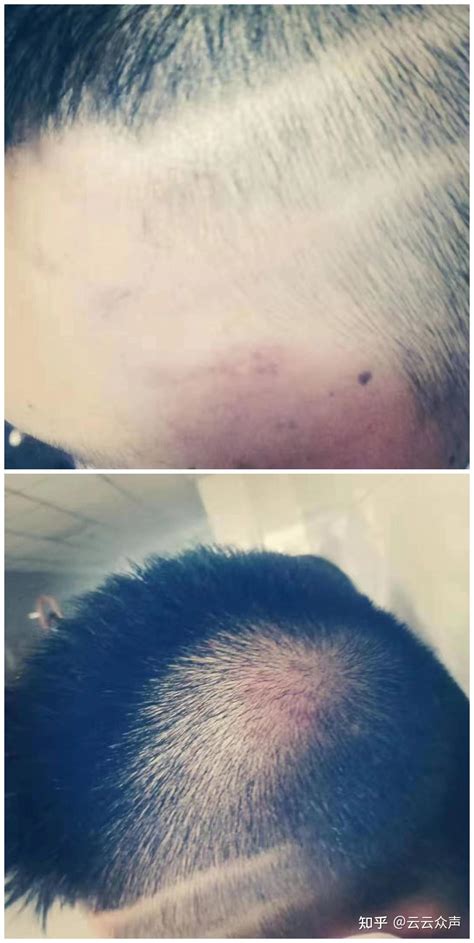 遭校园霸凌，施暴者5人为何只处罚1人？ 知乎