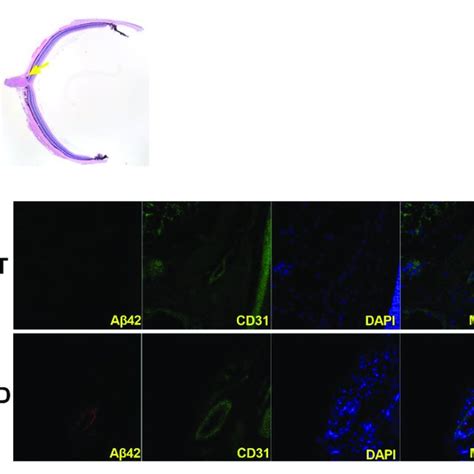 A Representative Hande Stained Transverse Retinal Section And Yellow