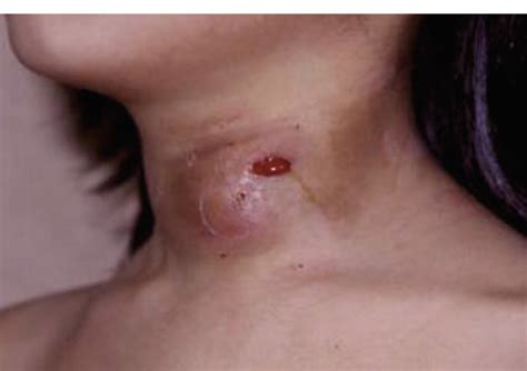 Am Test 4 Review Flashcards Quizlet