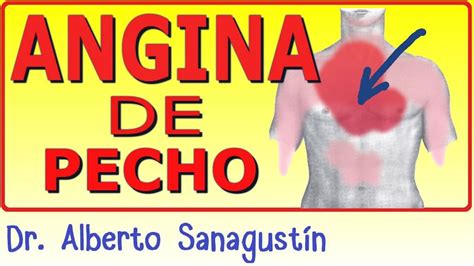 ANGINA DE PECHO causas fisiopatología síntomas ECG y tratamiento