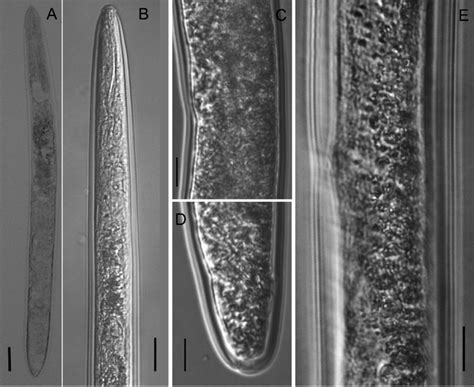 Light Micrographs Of Paratrichodorus Porosus From Acacia Mangium And
