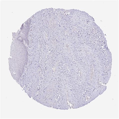 Tissue Expression Of Epcam Staining In Skin The Human Protein Atlas