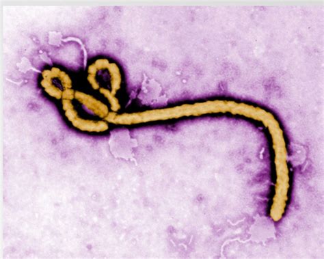 Rna Virus Filoviridae Flashcards Quizlet