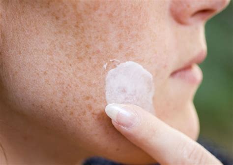 Should You Squeeze Your Spots Pimple Popping Hacks Revealed Express Co Uk