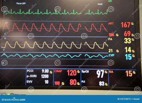 Medical Monitor Stock Image Image Of Illness Device 53724073