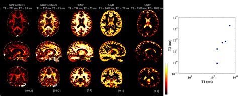 Threeorthogonal Tissue Segmentation Results Of Sparsity Promoting