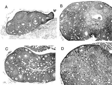 Photomicrograph Of Ovarian Pathology From Des Treated Mice A Ovary