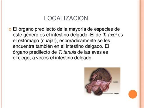 Trichostrongylus Spp