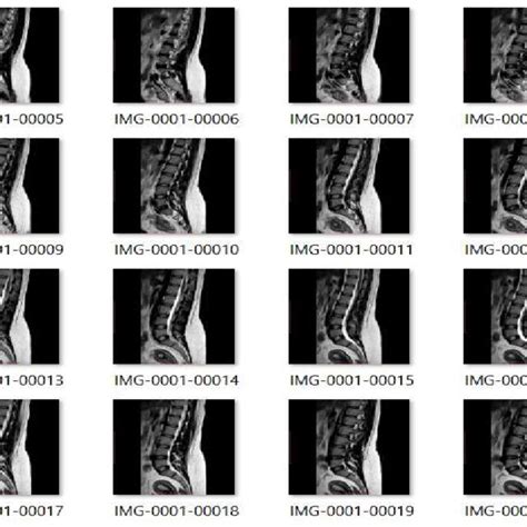 Sample Sci Database With Disease Type Abnormal And Normal Cases Of Download Scientific Diagram