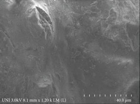 Scanning Electron Microscopy Of The External And Internal Part Of