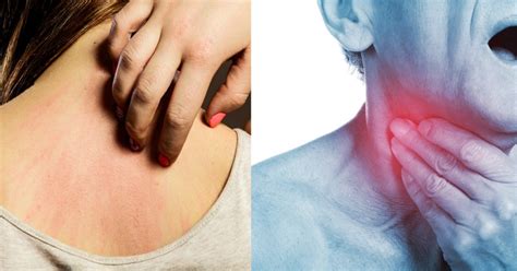 Early Warning Signs That Cancer Is Growing In Your