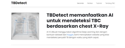 GitHub Brnsbrn TBDetect Application That Can Define Someone With Tuberculosis Using Chest X Ray