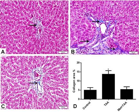 Metformin Protects Against Taa Induced Liver Fibrosis A C Massons