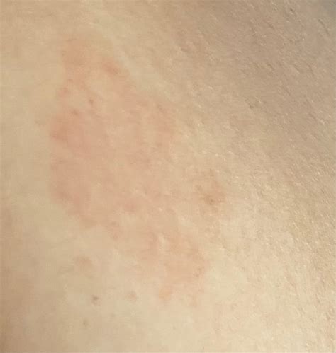 이거 장미빛 비강진 맞나요 지식in