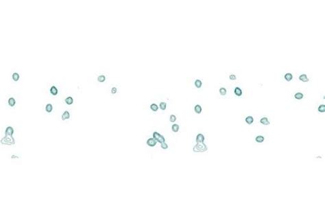 Flemming Hansen Crick