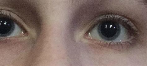 Mdma Rdilatedpupils