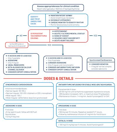 ProMed Certifications Algorithms Tachycardia With A Pulse ACLS Algorithm