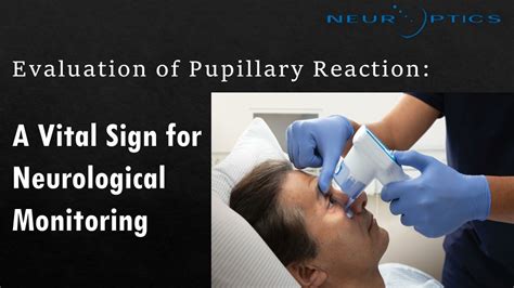 Ppt Evaluation Of Pupillary Reaction A Vital Sign For Neurological Monitoring Powerpoint