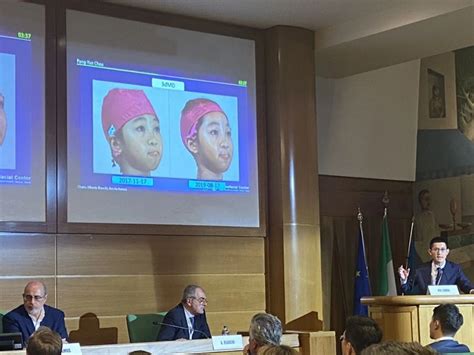 Pang Yun Chou On Linkedin Orthognathicsurgery Obstructivesleepapnea Cleftlip Cleftpalate…
