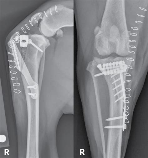 Clinical Image What Surgical Procedure Was Performed