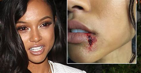 Chris Browns Ex Karrueche Tran Causes Outrage With Domestic Violence