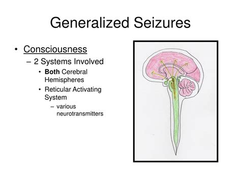 Ppt Epilepsy And Seizures Powerpoint Presentation Free Download Id