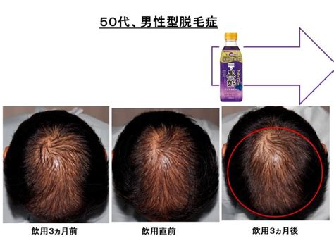 黒酢飲用続けて、効果も持続！ 患者様からの声・メディア掲載・クリニックからのお知らせ 名古屋kクリニック