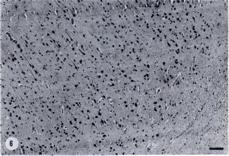 In The Cerebral Cortex Pyramidal Cells And Their Cytoplasmic Processes Download Scientific