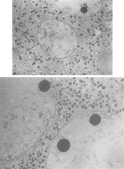 And 20 Pronuclear Formation 24 Hr After Microinjection Fig 19 Top Download Scientific