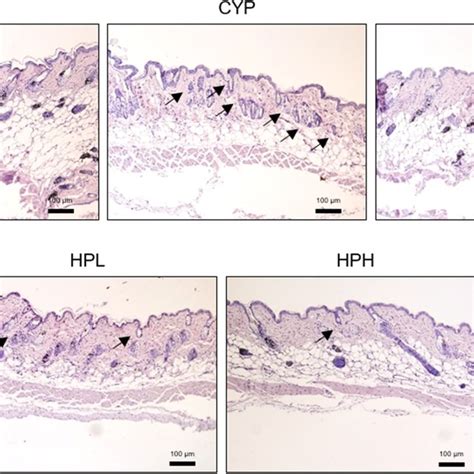 Expression Of Ki67 Positive Cells In Hair Follicles Brown Stained