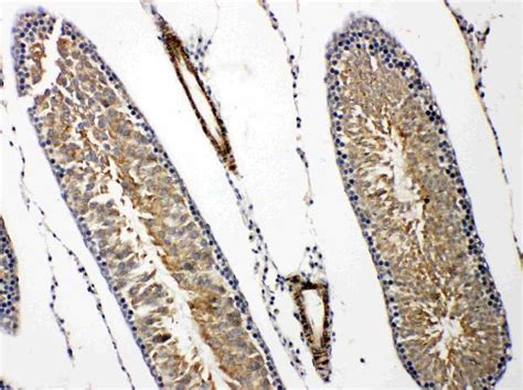 Prolactin Receptorprlr Antibody