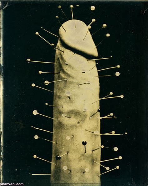 طب سوزنی کیری