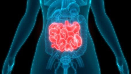 Small Intestine Cancer Condition UAMS Health
