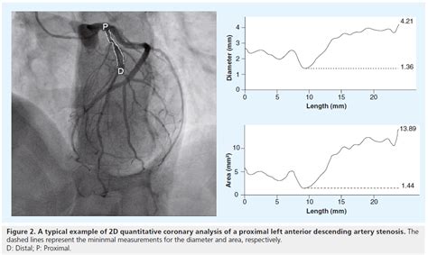 3d Fluoroscopy Based Imaging In The Cardiovascular Catheterizatio