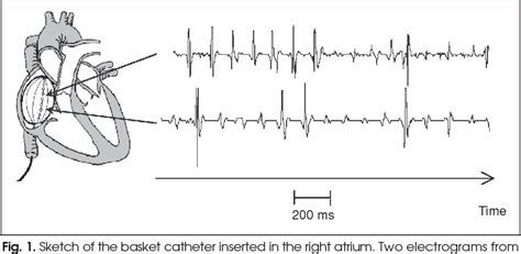 Figure 1 From Descriptors Of Wavefront Propagation Semantic Scholar