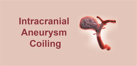 Intracranial Aneurysm Coiling Procedure Benefits And Risks