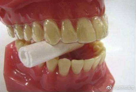 隐形矫正的辅助神器咬胶你用对了吗 咬胶 牙套 牙齿 新浪新闻