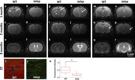 Rat Brain Mri At Laura Sutter Blog