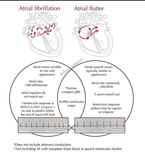 The Heart 🔴atrial Fibrillation Vs Atrial Flutter 🫀 Facebook