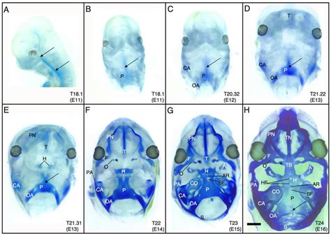 Morphogenesis Of The Chondrocranium As Shown By Alcian Blue Stained And
