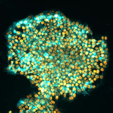 Scientists Discover Dynamite” Way To Wipe A Cells Memory To Better
