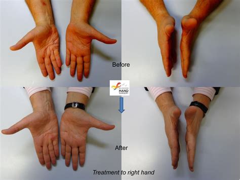 Melbourne Hand Surgery Melbourne Hand Surgery