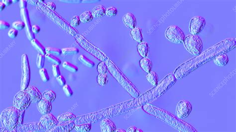 Trichosporon Fungus Illustration Stock Image F0360572 Science